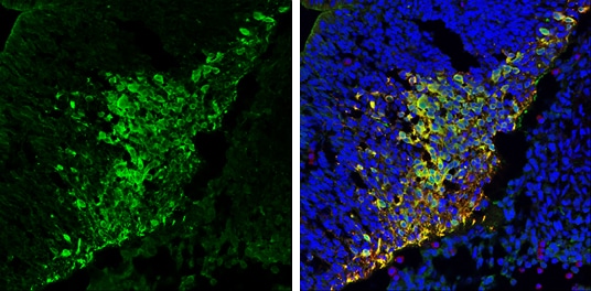 PGP9.5 Antibody (PA5-29012)