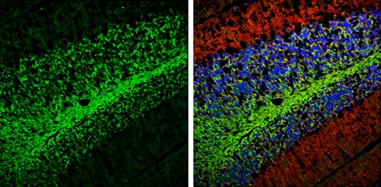 PGP9.5 Antibody (PA5-29012)