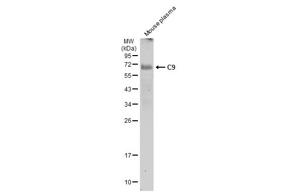 Complement C9 Antibody (PA5-29093)