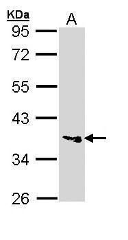 PPT1 Antibody (PA5-29177)
