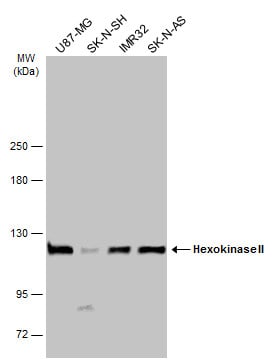 HK2 Antibody (PA5-29326)