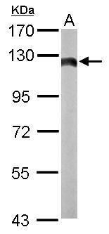 HK2 Antibody (PA5-29326)
