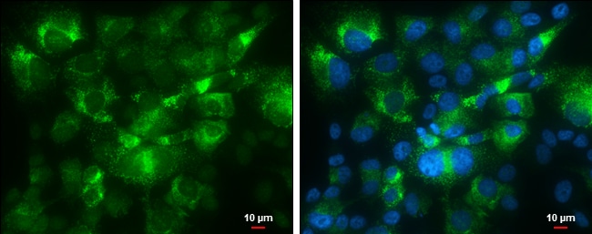 COL1A1 Antibody (PA5-29569)