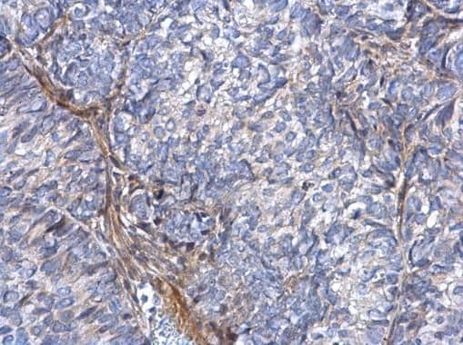 COL1A1 Antibody (PA5-29569)