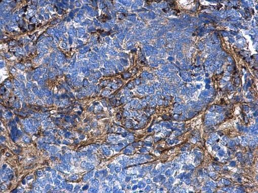 COL1A1 Antibody (PA5-29569)