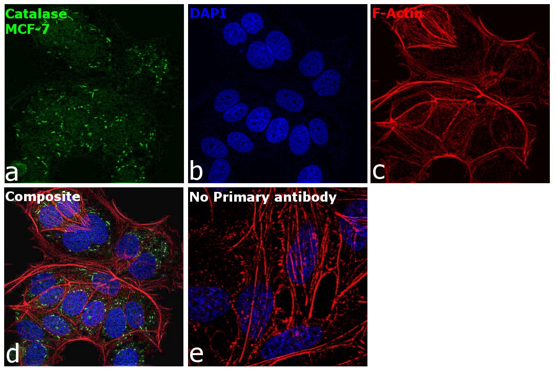 Catalase Antibody (PA5-29650)