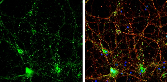 ChAT Antibody (PA5-29653)