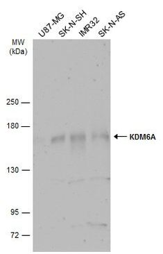 KDM6A Antibody (PA5-31828)