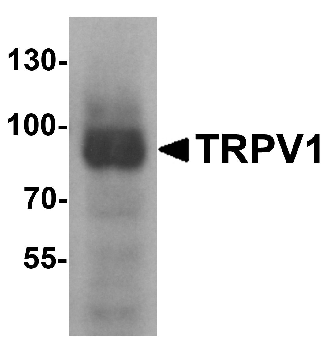 TRPV1 Antibody (PA5-34498)