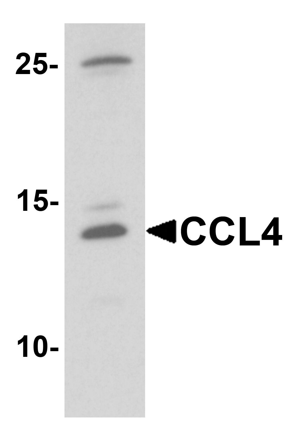CCL4 Antibody (PA5-34509)