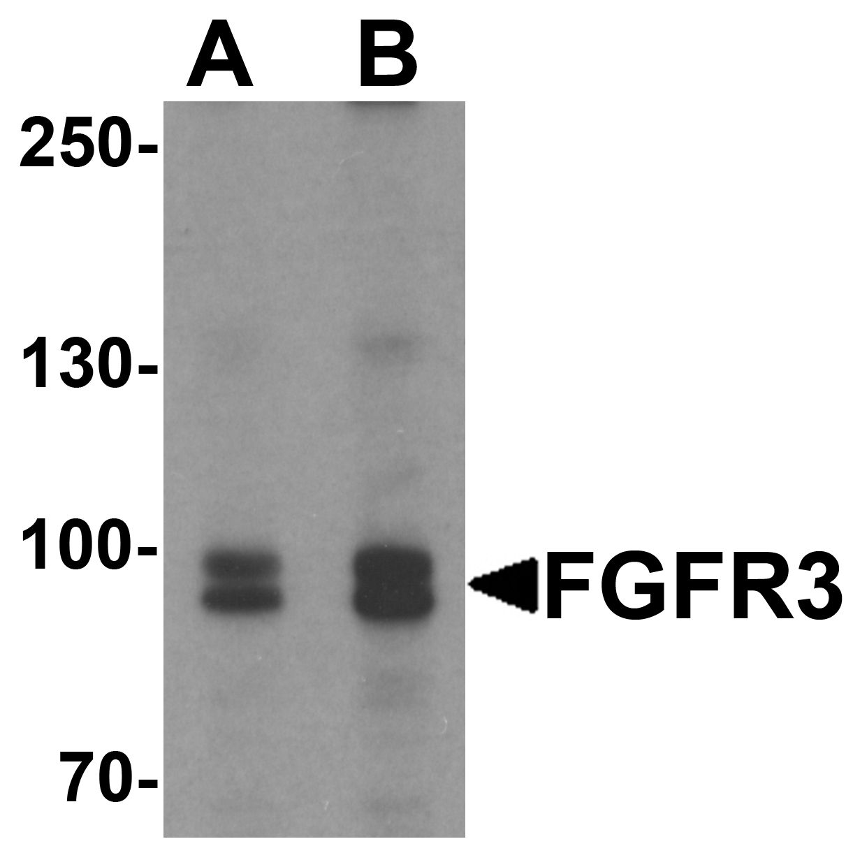 FGFR3 Antibody (PA5-34574)