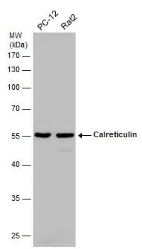 Calreticulin Antibody (PA5-34786)