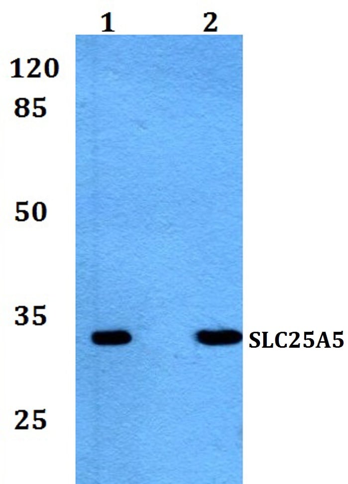 SLC25A5 Antibody (PA5-37120)