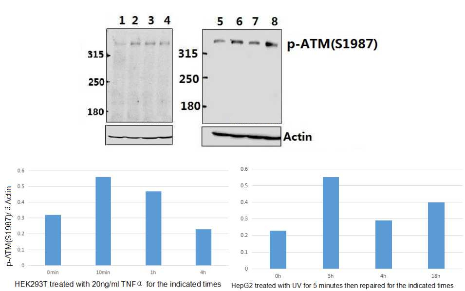 Phospho-ATM (Ser1987) Antibody (PA5-37346)