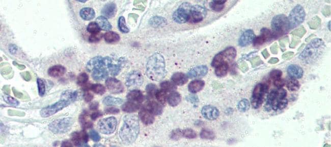 PRDM9 Antibody (PA5-41161)