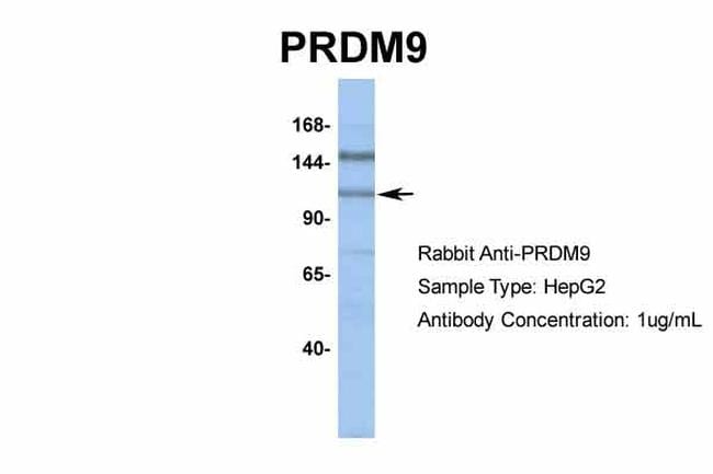 PRDM9 Antibody (PA5-41161)