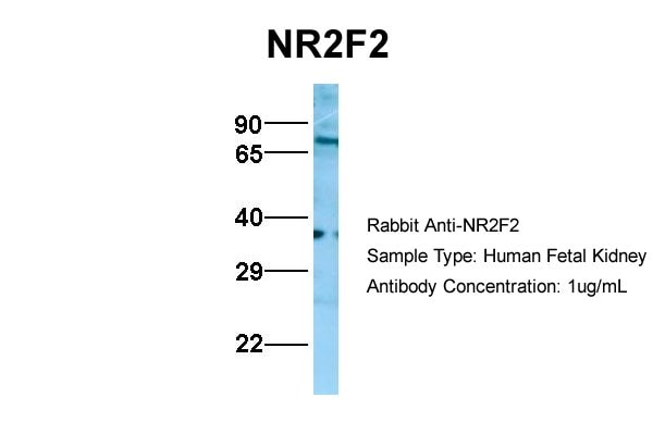 NR2F2 Antibody (PA5-41613)