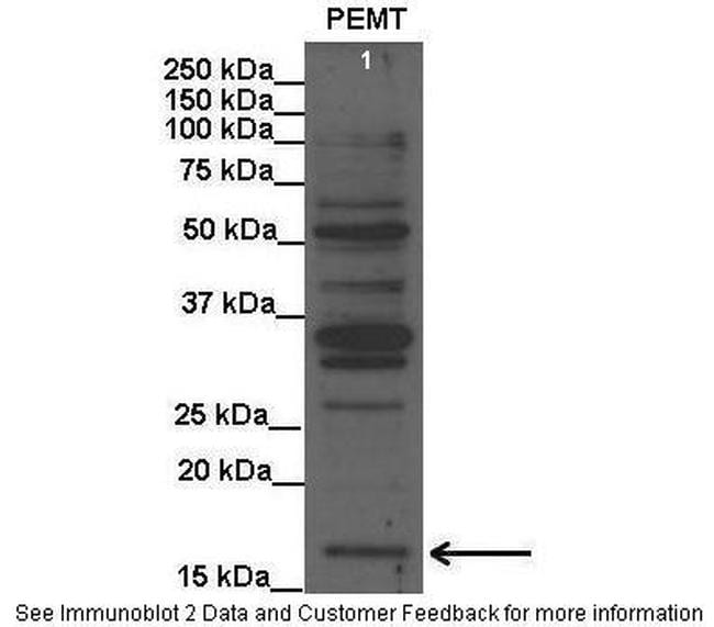 PEMT Antibody (PA5-42383)