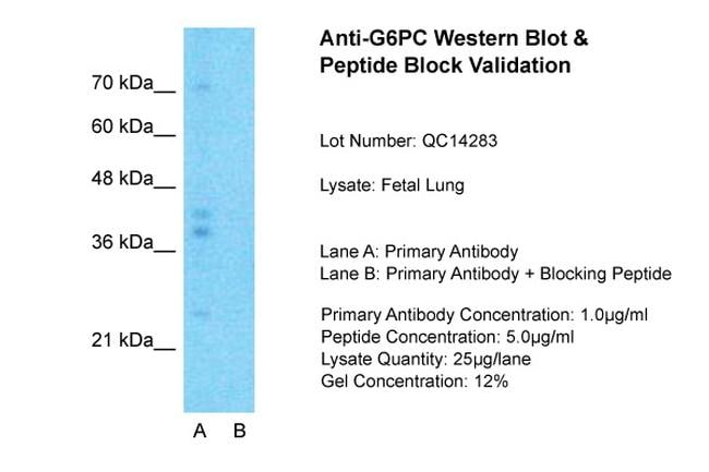 G6PC Antibody (PA5-42541)