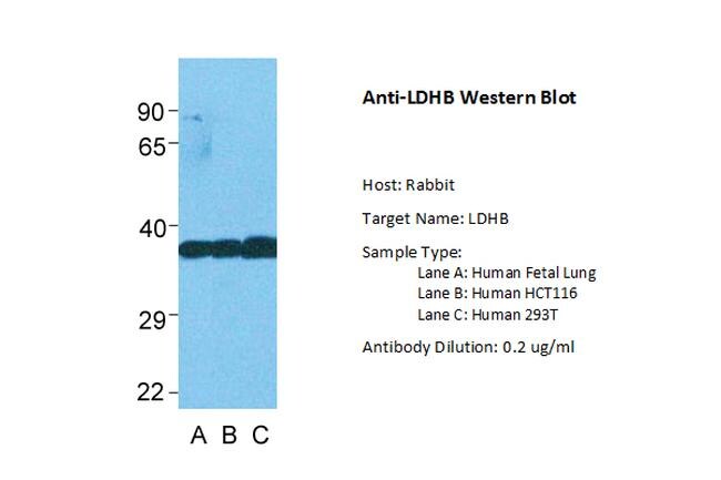 LDHB Antibody (PA5-43141)