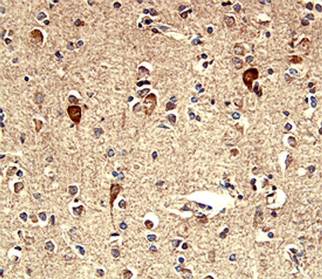 TROP2 Antibody (PA5-47030)