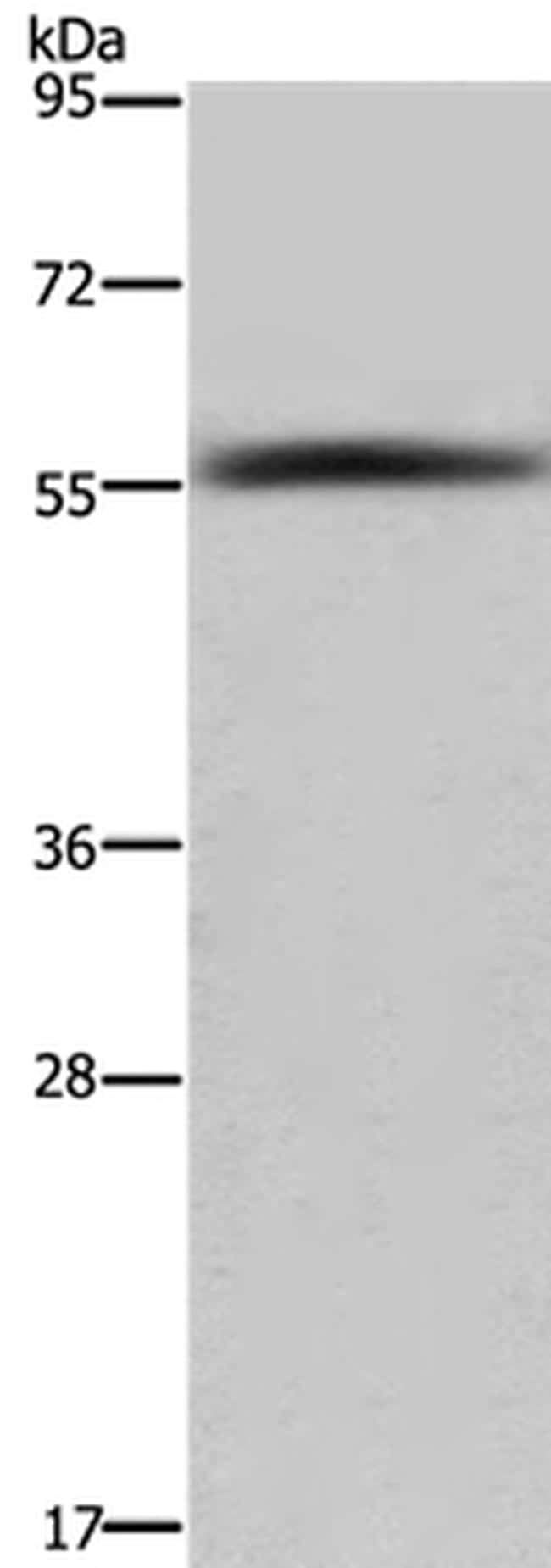 FAR2 Antibody (PA5-50411)