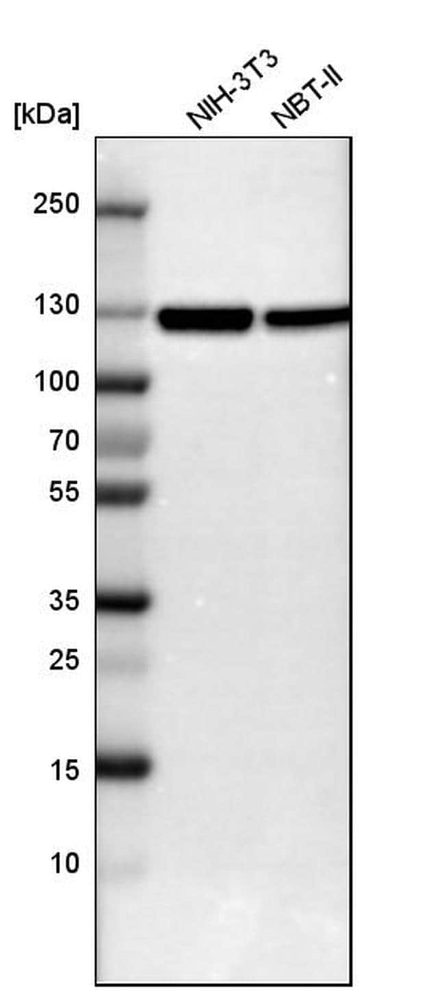 Complement Factor B Antibody (PA5-51640)