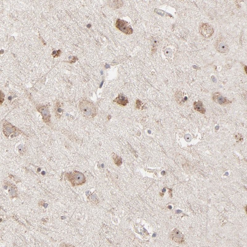 RNF213 Antibody (PA5-51902)