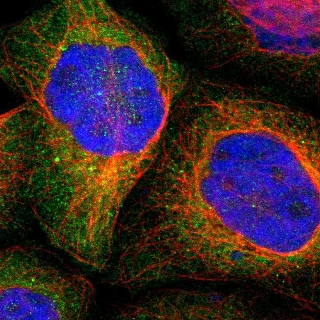 RNF213 Antibody (PA5-51902)