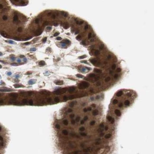 GALT Antibody (PA5-52125)