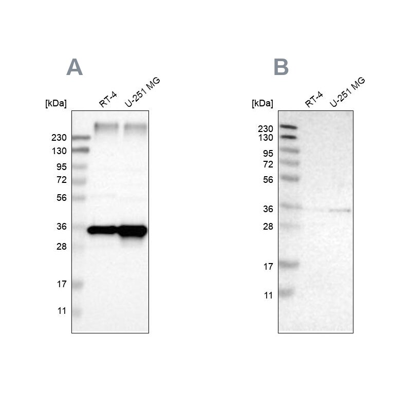 TRAP alpha Antibody (PA5-52811)