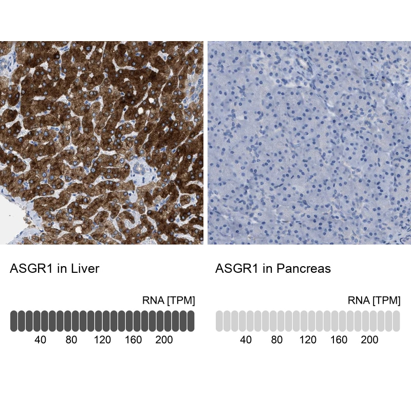ASGR1 Antibody (PA5-52885)