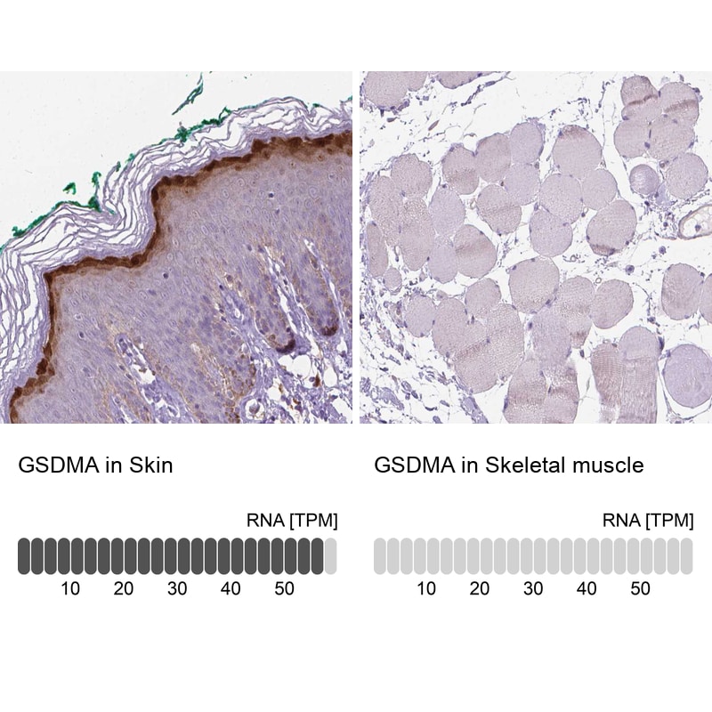 GSDMA Antibody (PA5-54757)
