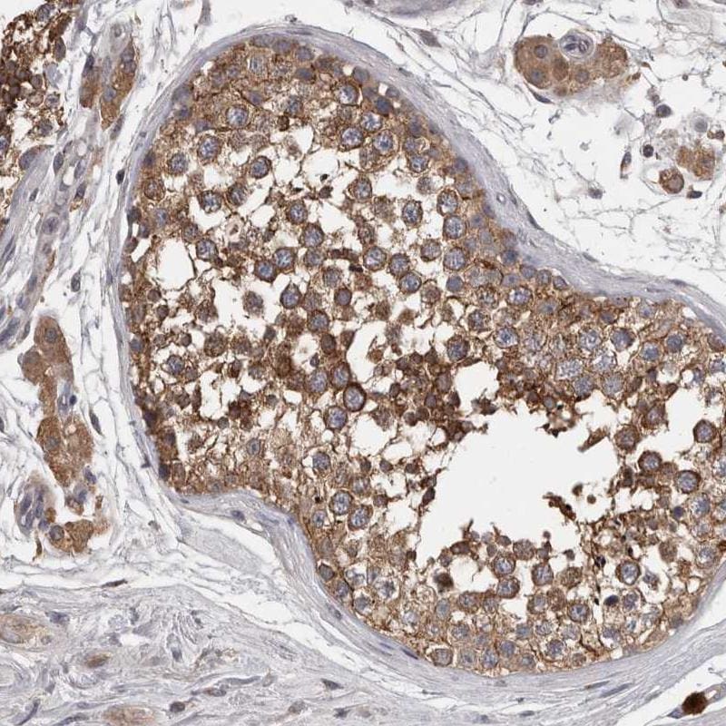PCM1 Antibody (PA5-54779)