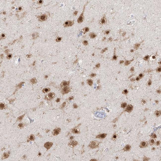 NeuN Antibody (PA5-56560)