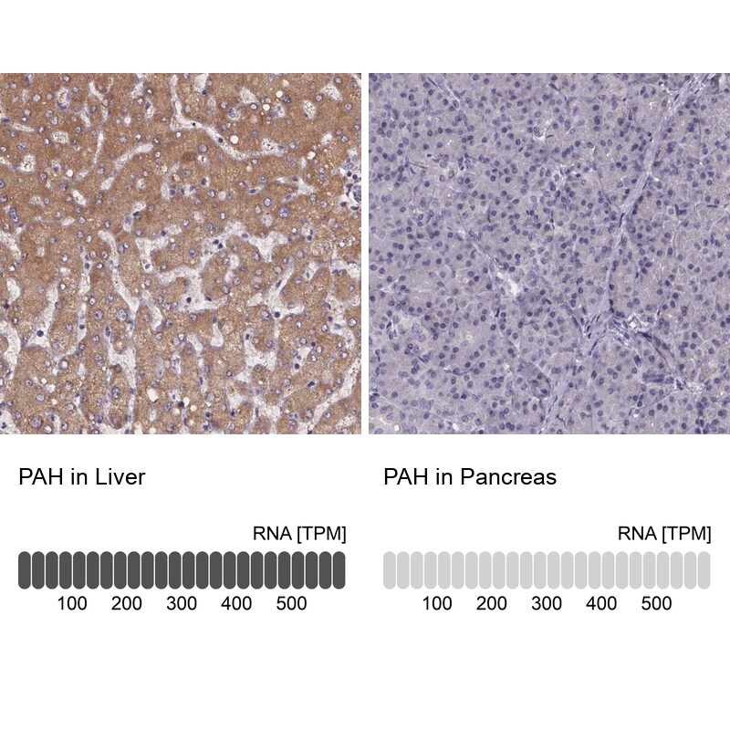PAH Antibody (PA5-56807)