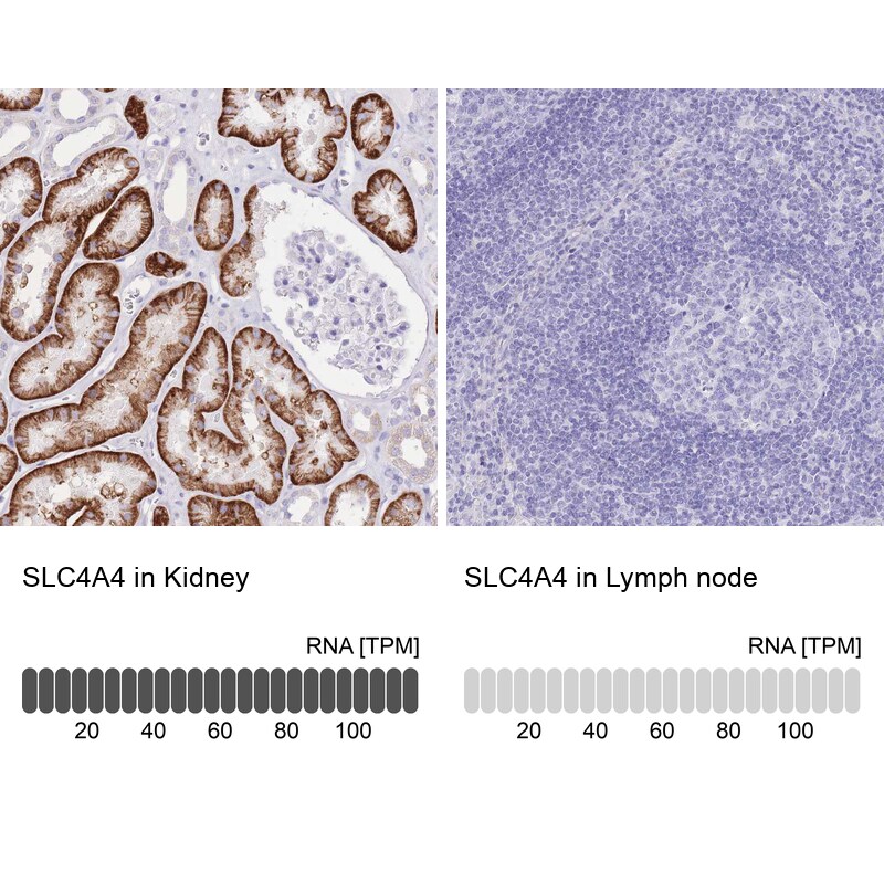 SLC4A4 Antibody (PA5-57344)