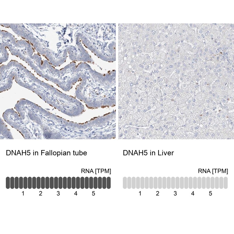 DNAH5 Antibody (PA5-57958)