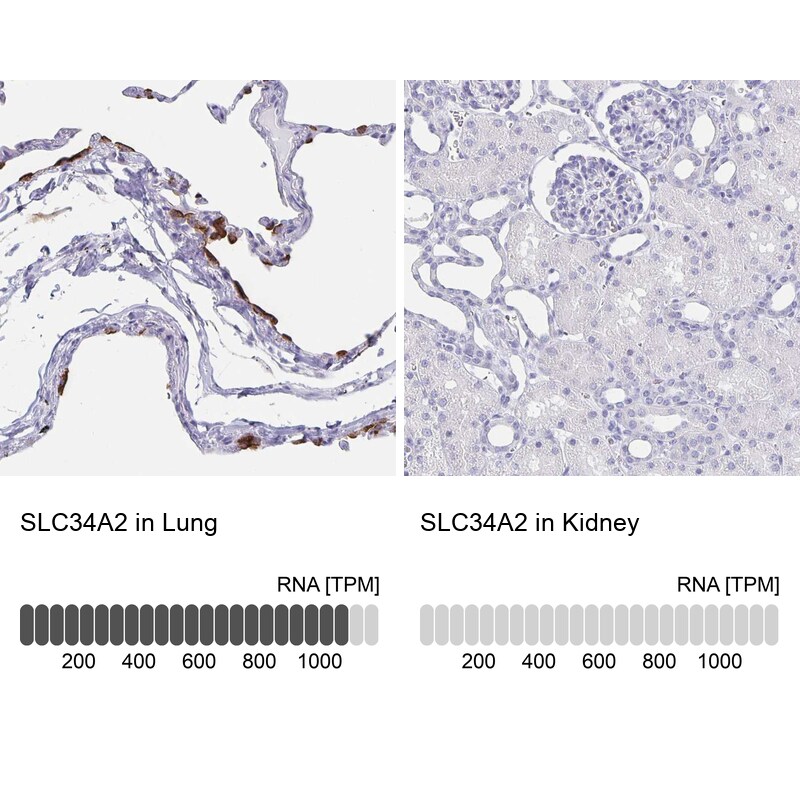 SLC34A2 Antibody (PA5-58198)