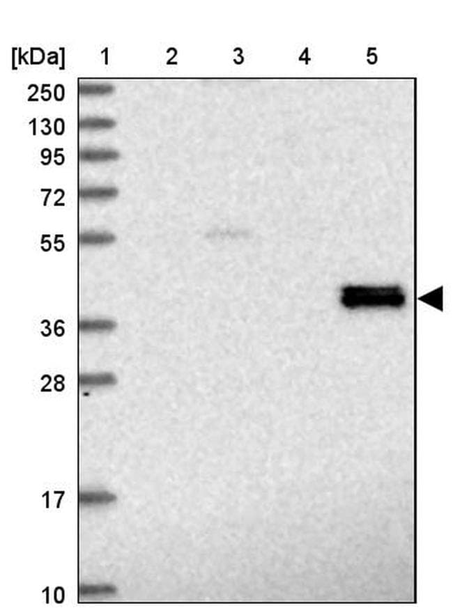 ADH7 Antibody (PA5-58887)