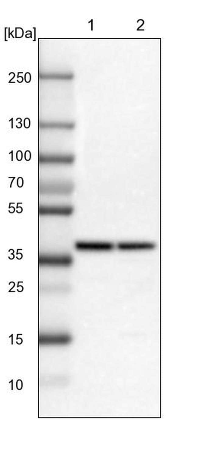 ADH7 Antibody (PA5-58887)