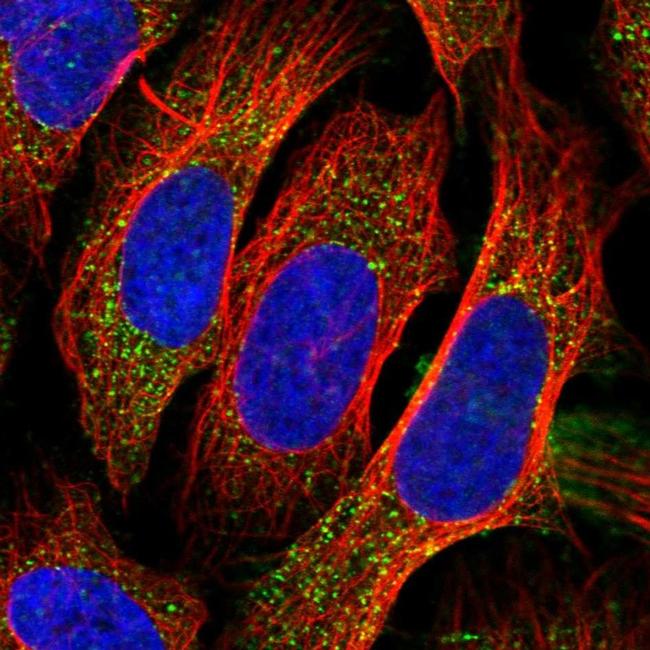 PEX14 Antibody (PA5-61151)