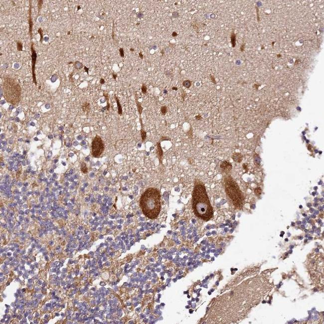 DDX27 Antibody (PA5-61421)