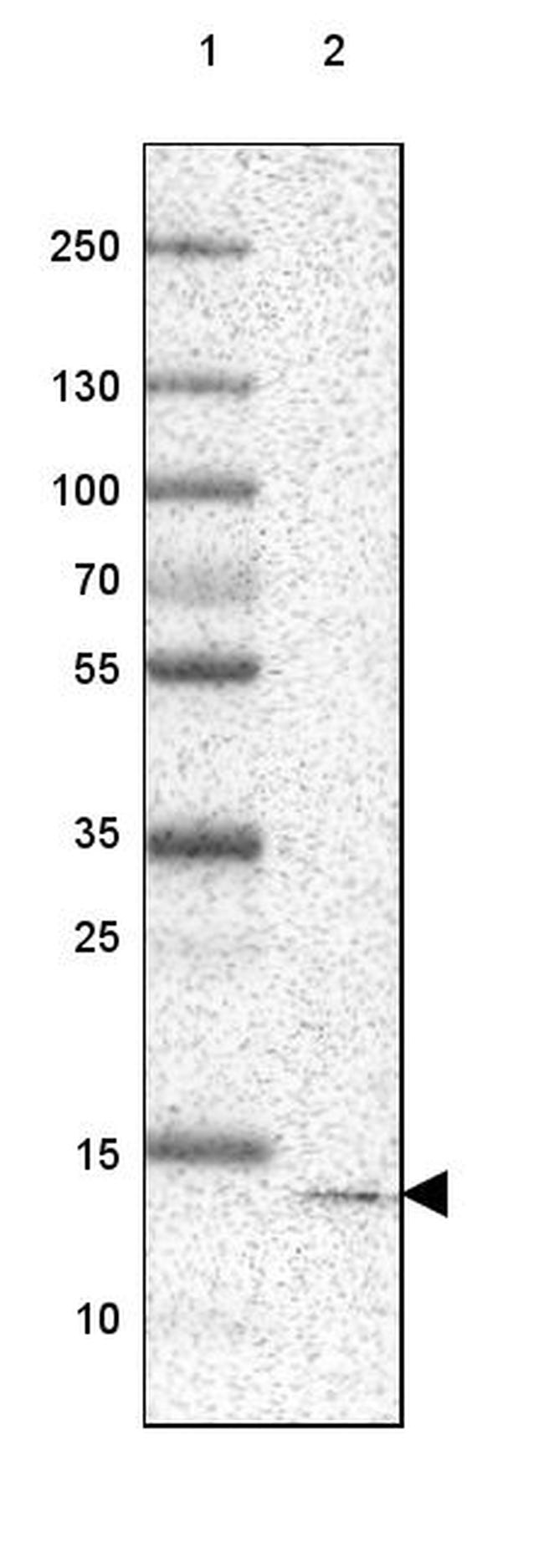 EMC6 Antibody (PA5-64051)
