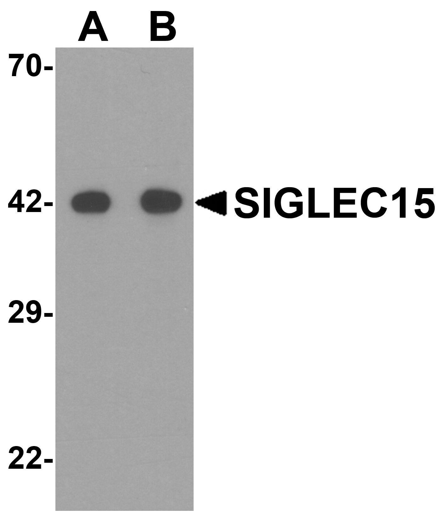 SIGLEC15 Antibody (PA5-72765)