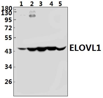 ELOVL1 Antibody (PA5-75396)