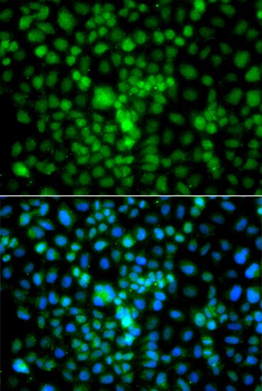 CIDEA Antibody (PA5-76236)