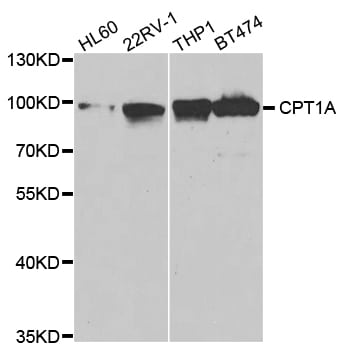 CPT1A Antibody (PA5-76788)