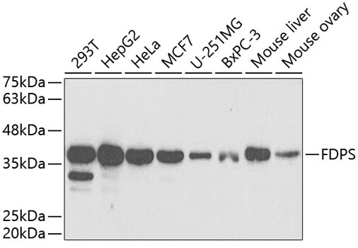 FDPS Antibody (PA5-76813)