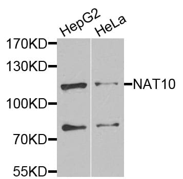 NAT10 Antibody (PA5-77193)